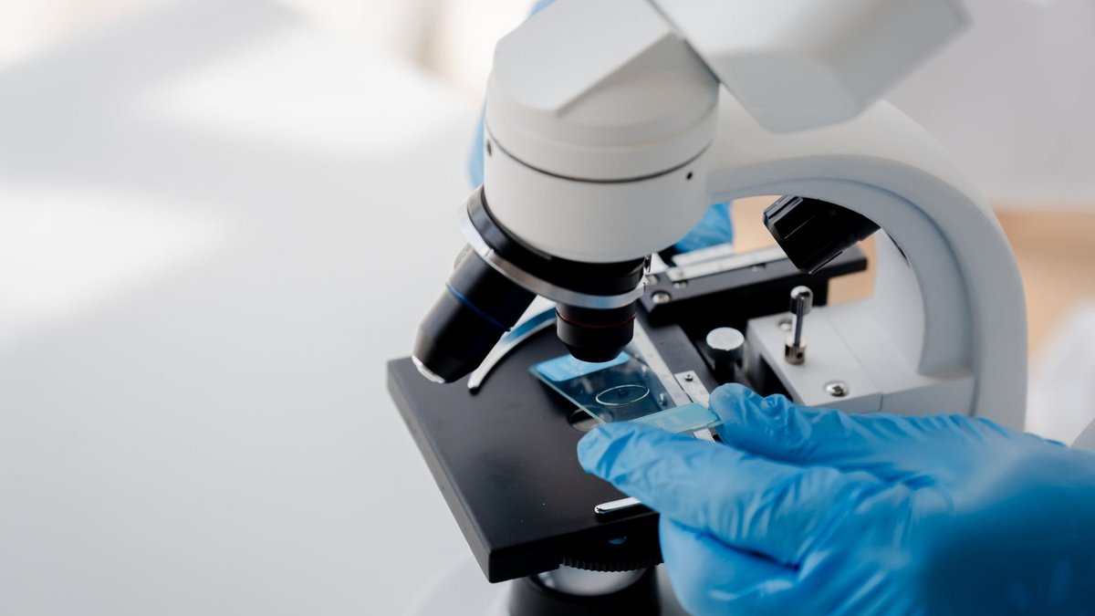 Mechanism that makes human soft tissues resistant discovered - polimi